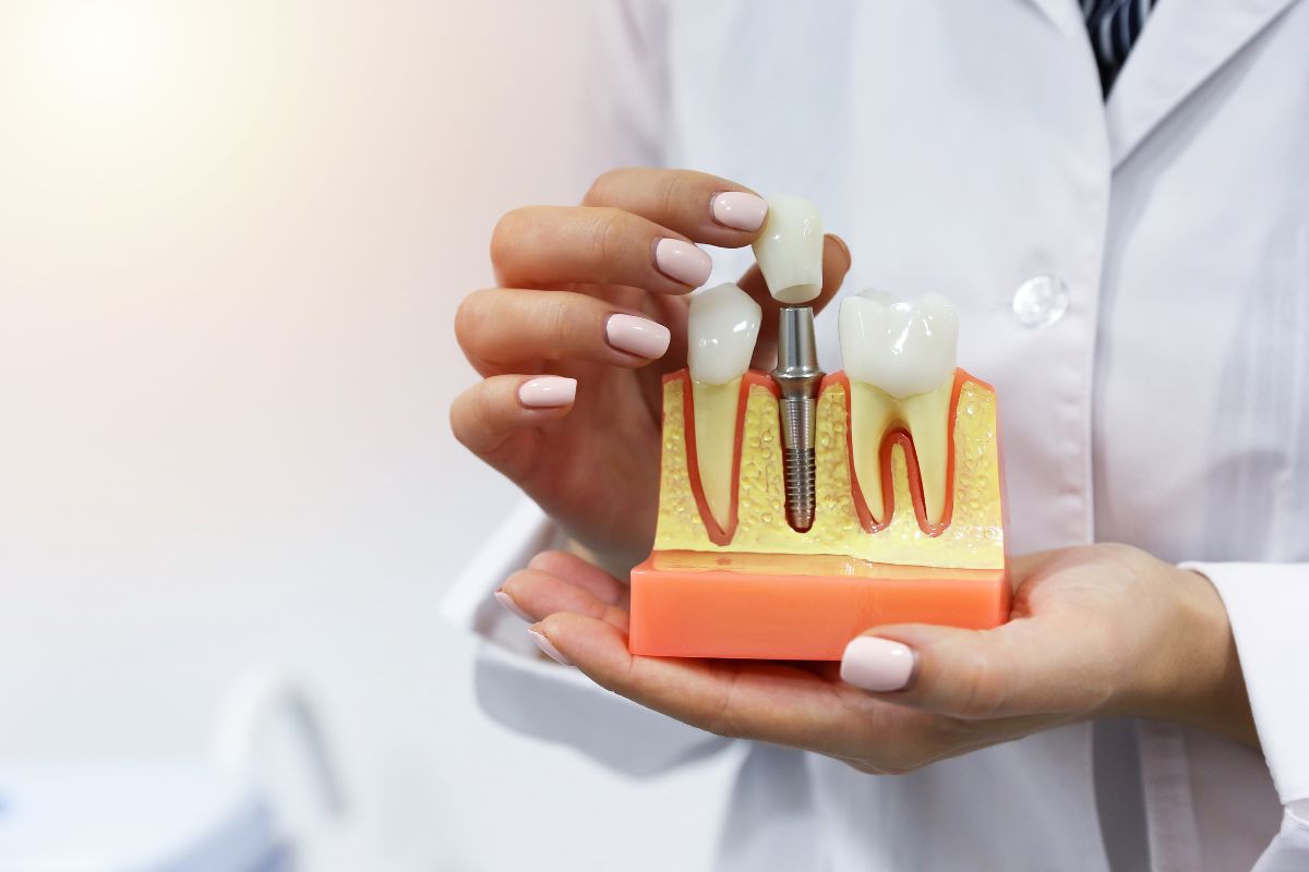 Dental Implant Healing Caps: What Every Patient Needs to Know